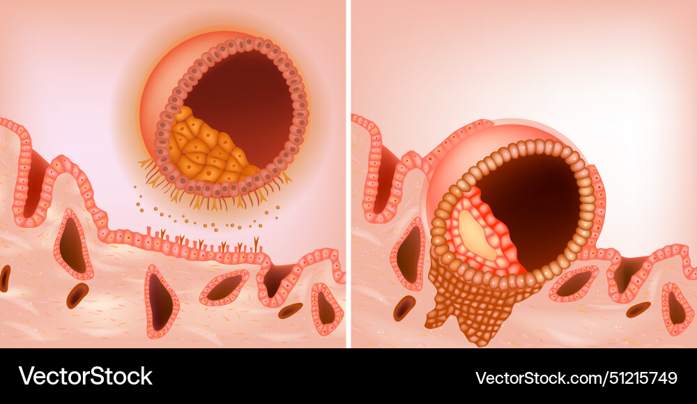 Process during the embryo implantation Royalty Free Vector