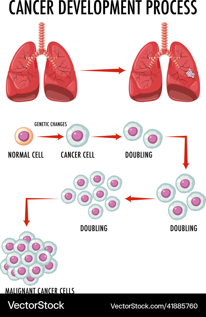 Diagram showing cancer development process Vector Image