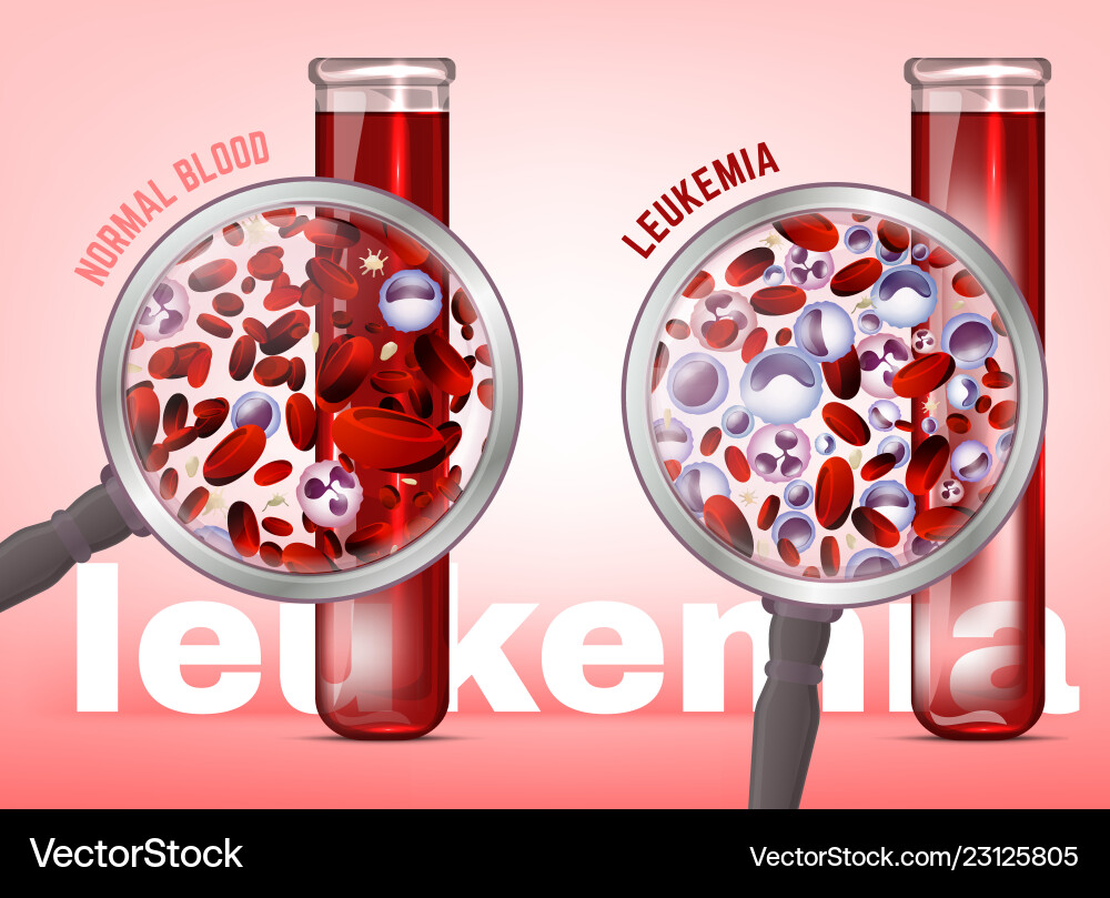 Leucemia Vector Images (21)