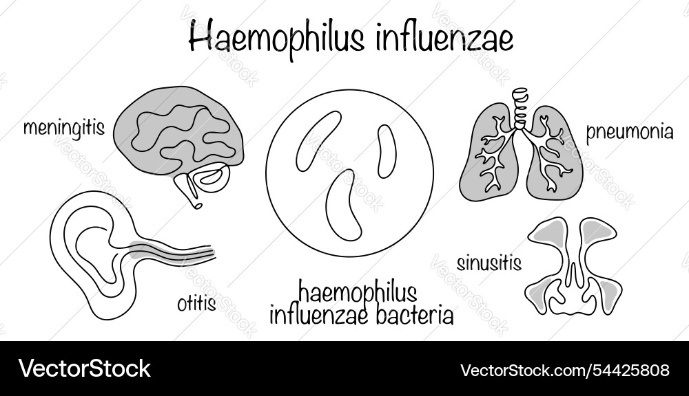 Haemophilus influenzae Royalty Free Vector Image