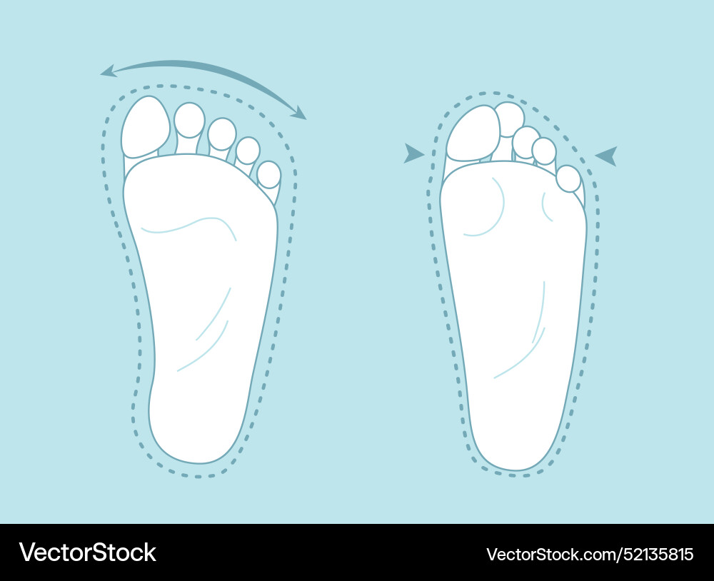 Healthy and deformed human feet comparison Vector Image