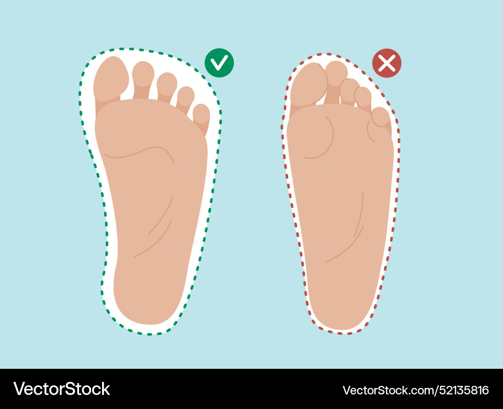 Healthy and deformed human feet comparison Vector Image