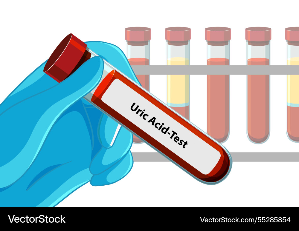 A blood test for uric acid Royalty Free Vector Image