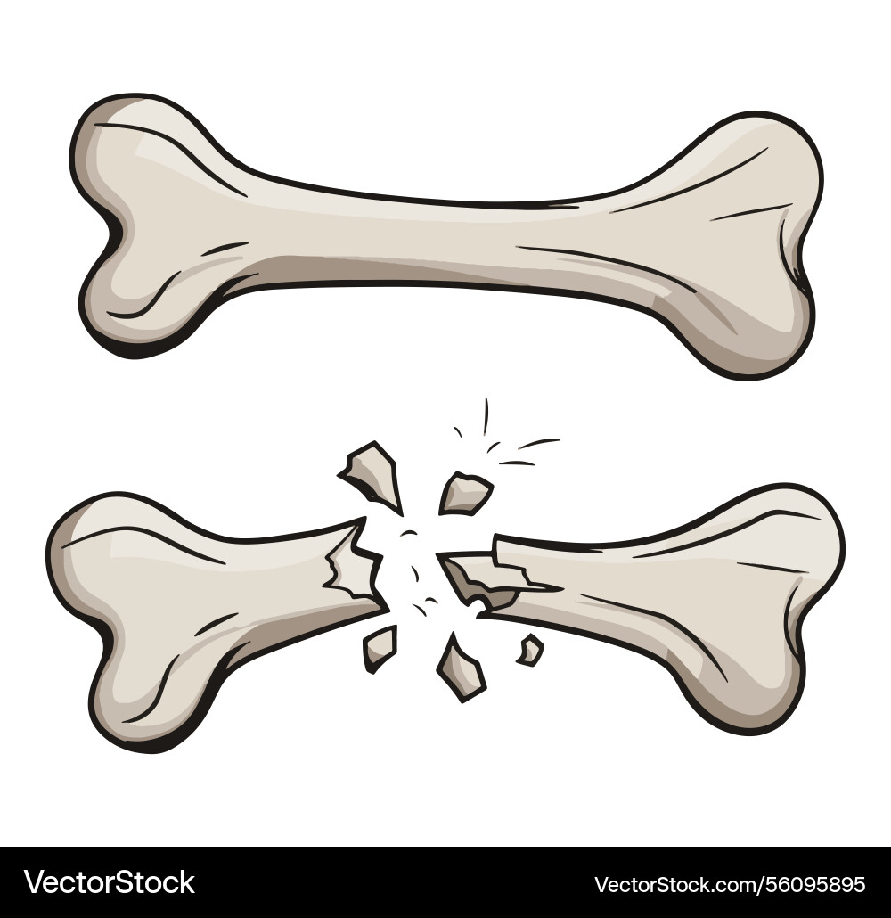 Set of human bone skeleton elements includes Vector Image