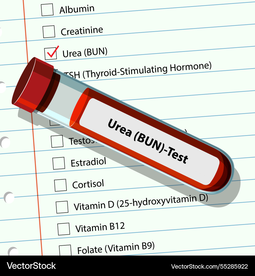 Blood test checklist and sample Royalty Free Vector Image