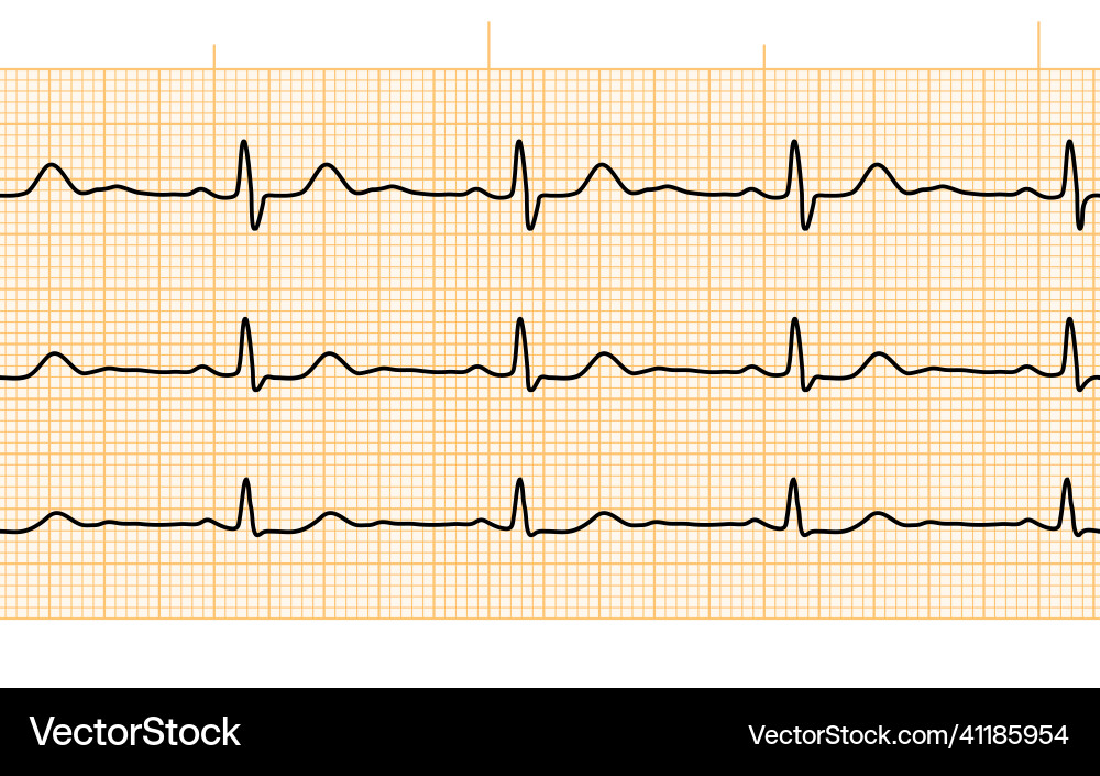 ECG Heartbeat Waveform Chart Royalty Free Vector Image
