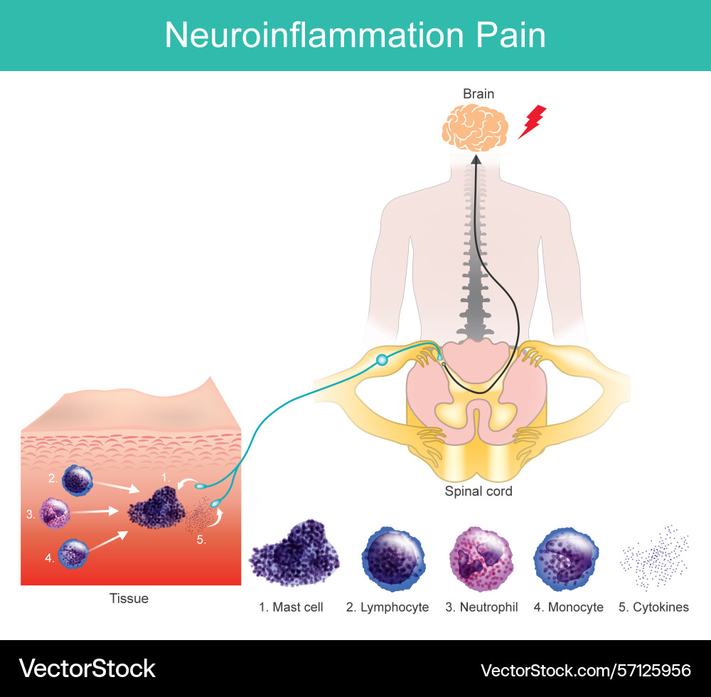 Neuroinflammation and pain pathway diagram Vector Image
