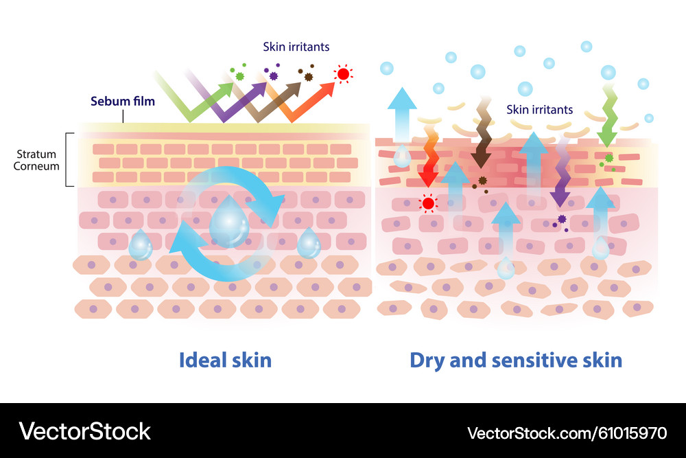 Dry vs. Sensitive Skin: A Cross-Section – Royalty-Free Vector | VectorStock