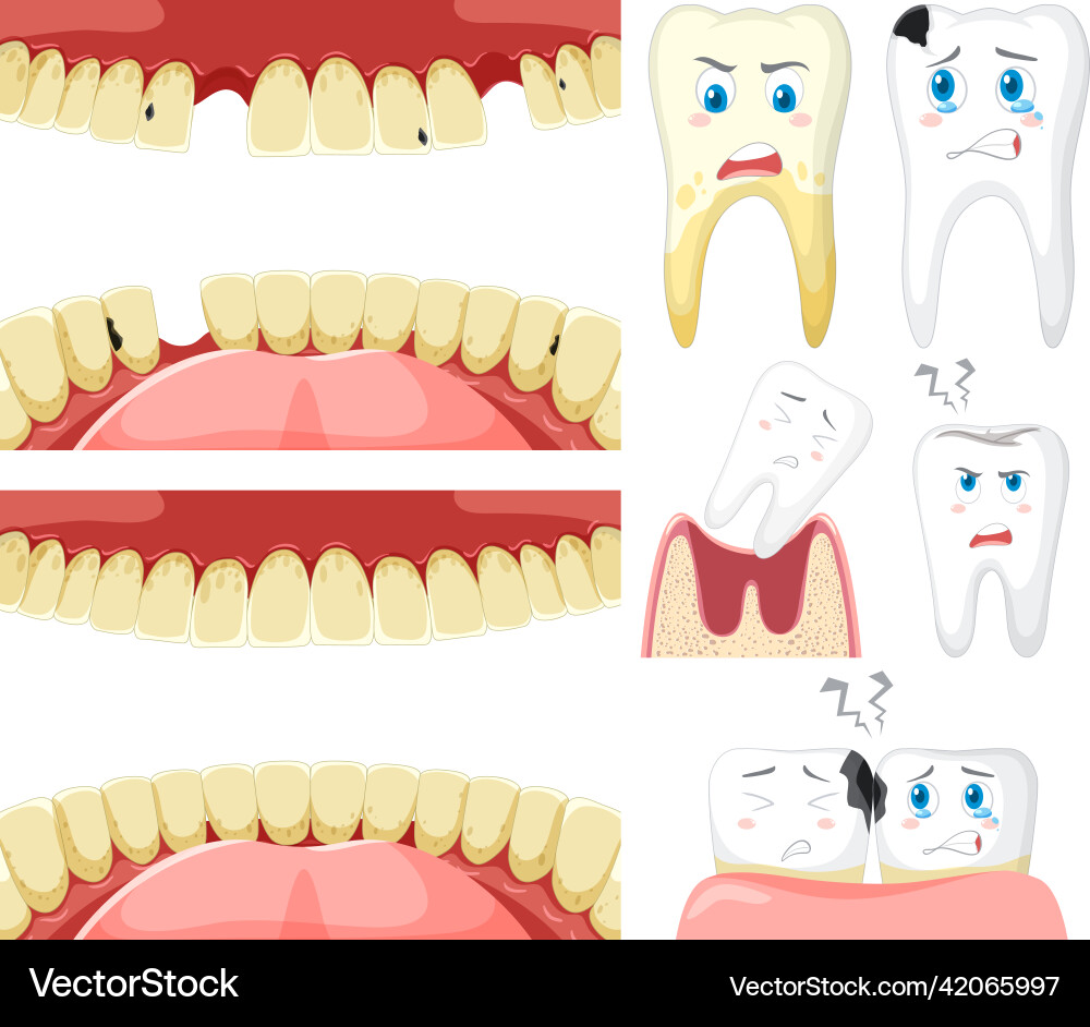 Set of all types teeth on white background Vector Image