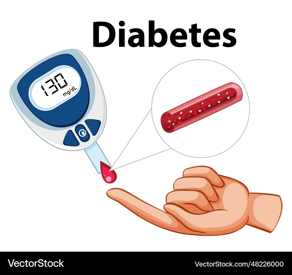 Glucose meter device for checking blood sugar Vector Image