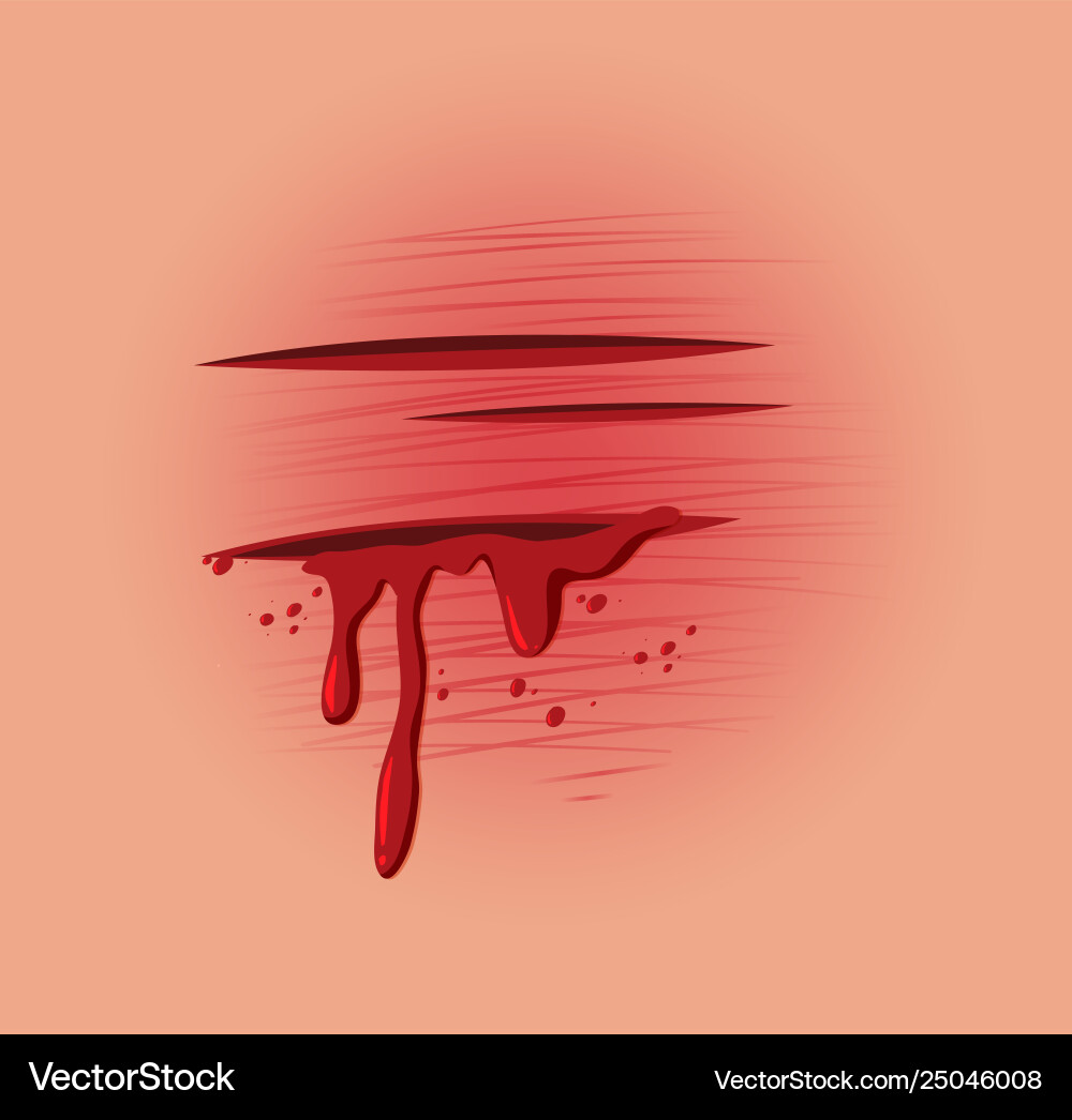 A fresh wound on skin Royalty Free Vector Image