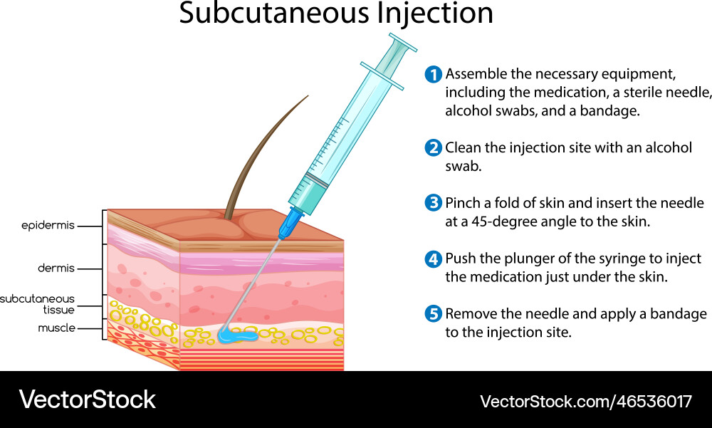 Subcutaneous injection with explanation Royalty Free Vector