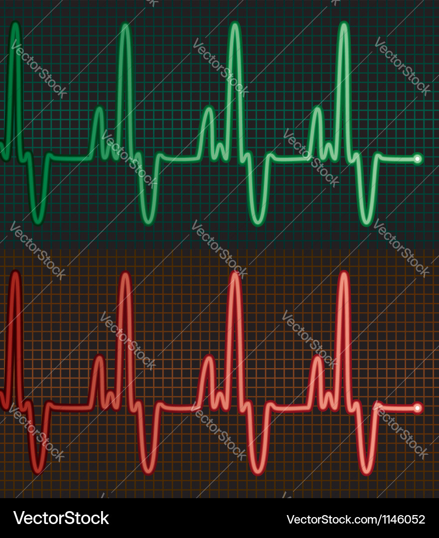 Electrocardiogram Royalty Free Vector Image - VectorStock