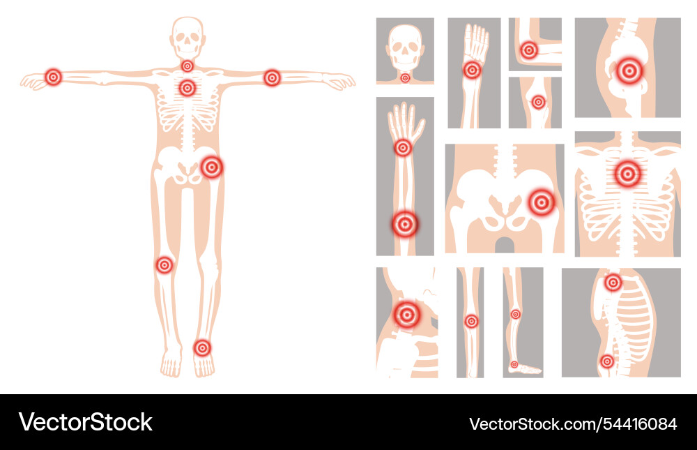 Human figure highlighting common pain points Vector Image