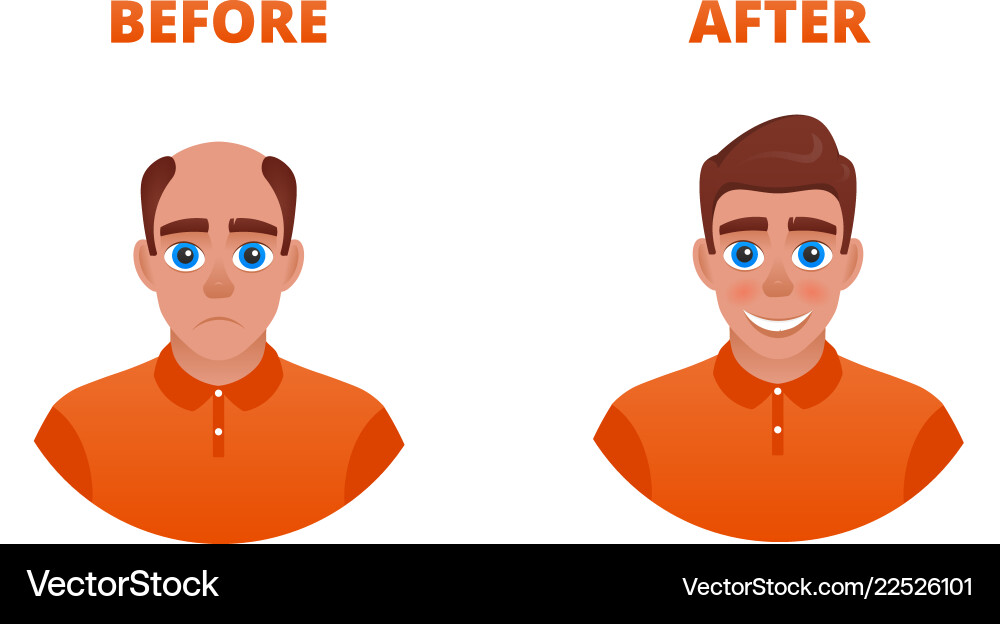 Hair growth concept Royalty Free Vector Image - VectorStock