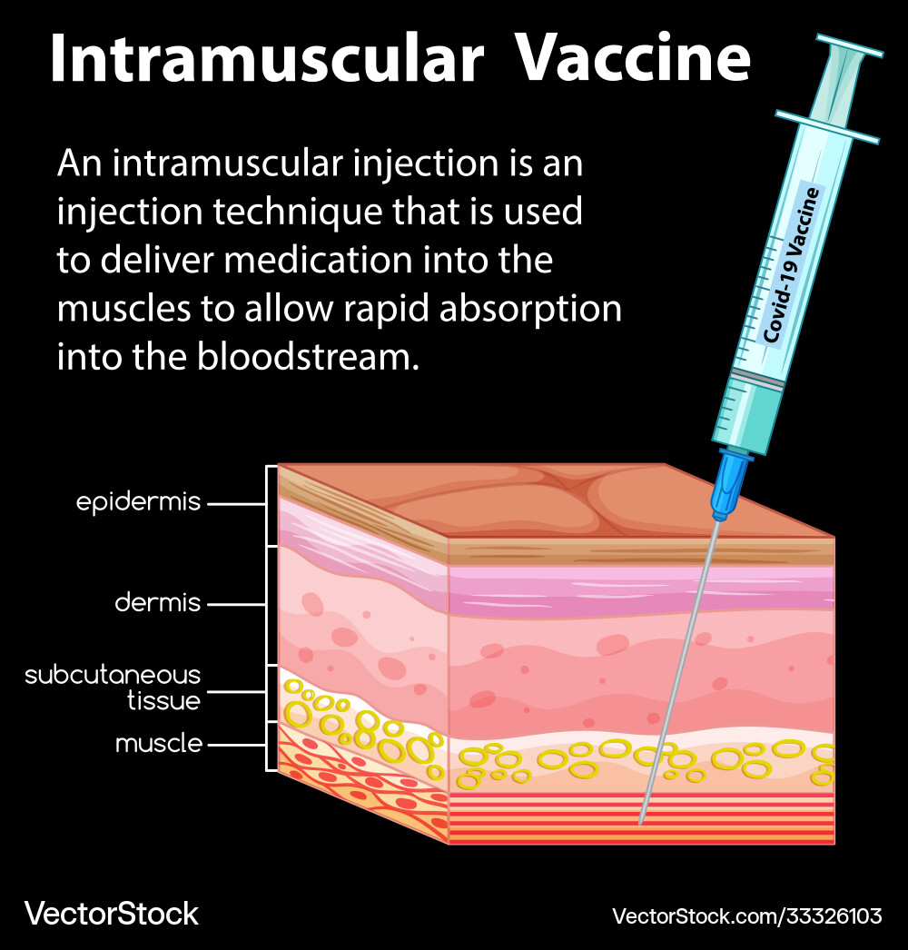 Informationen zur intramuskulären Injektion Vektorbild