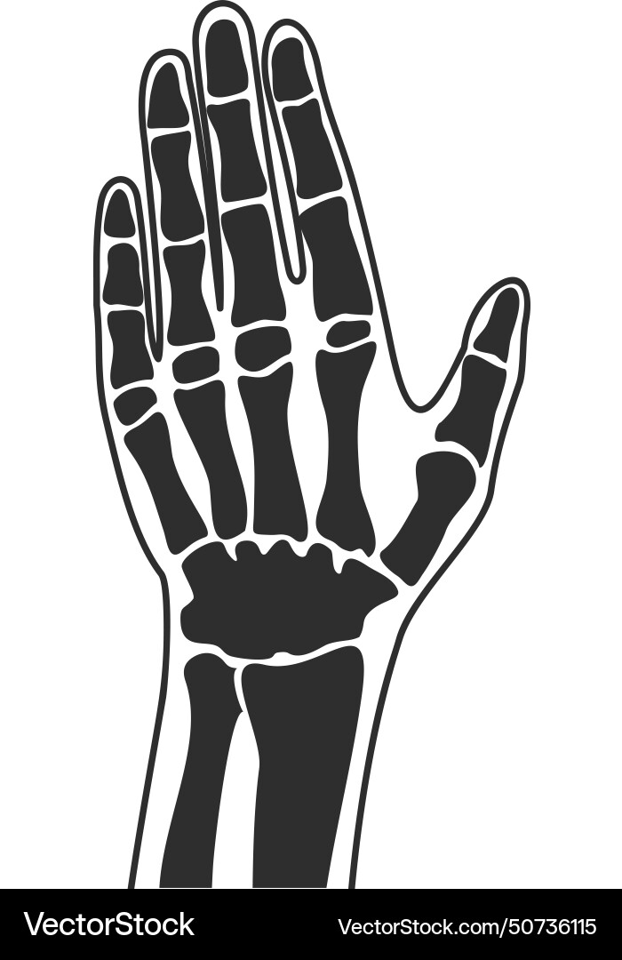 Human palm xray hand bones anatomy Royalty Free Vector Image