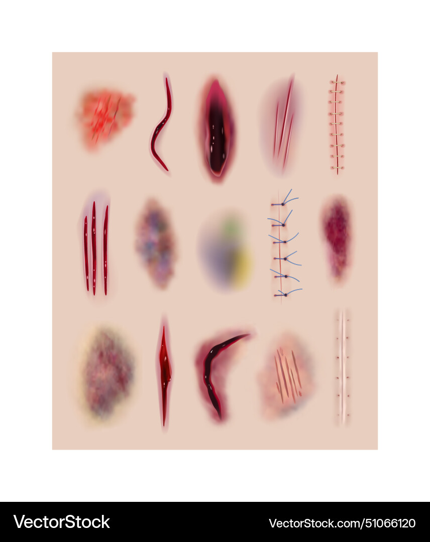 Bloody stitching cuts and wounds scars decent Vector Image