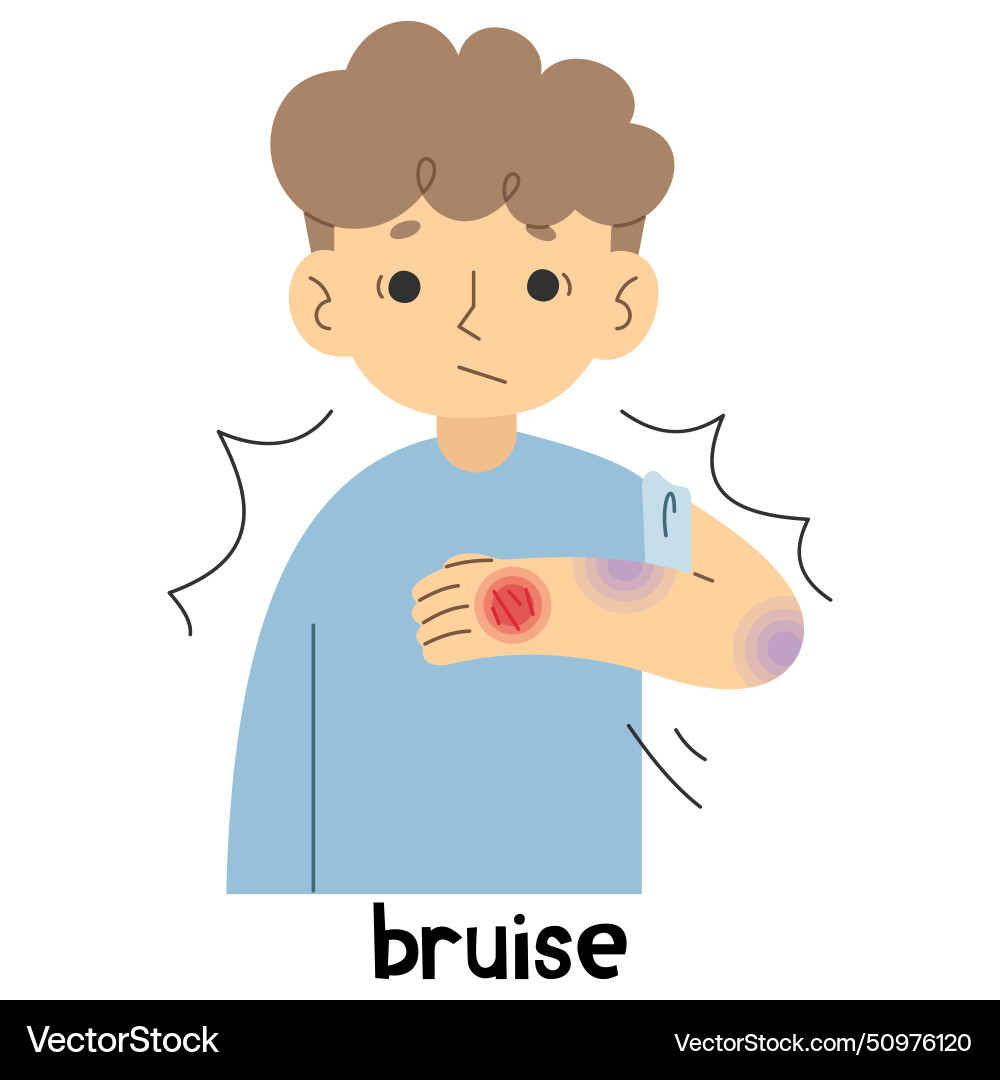 Bruise 1 Royalty Free Vector Image - VectorStock