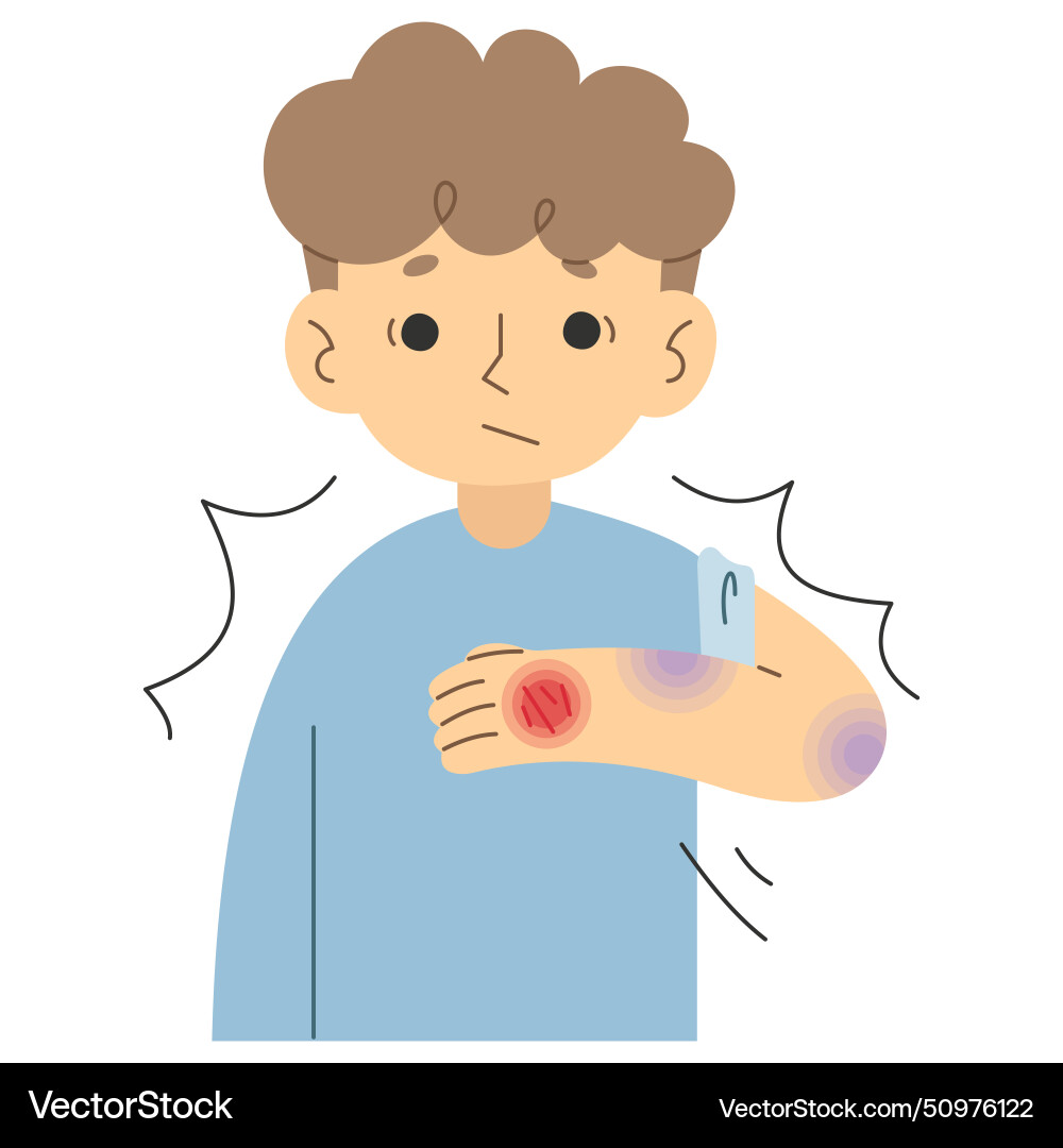 Bruise 2 Royalty Free Vector Image - VectorStock