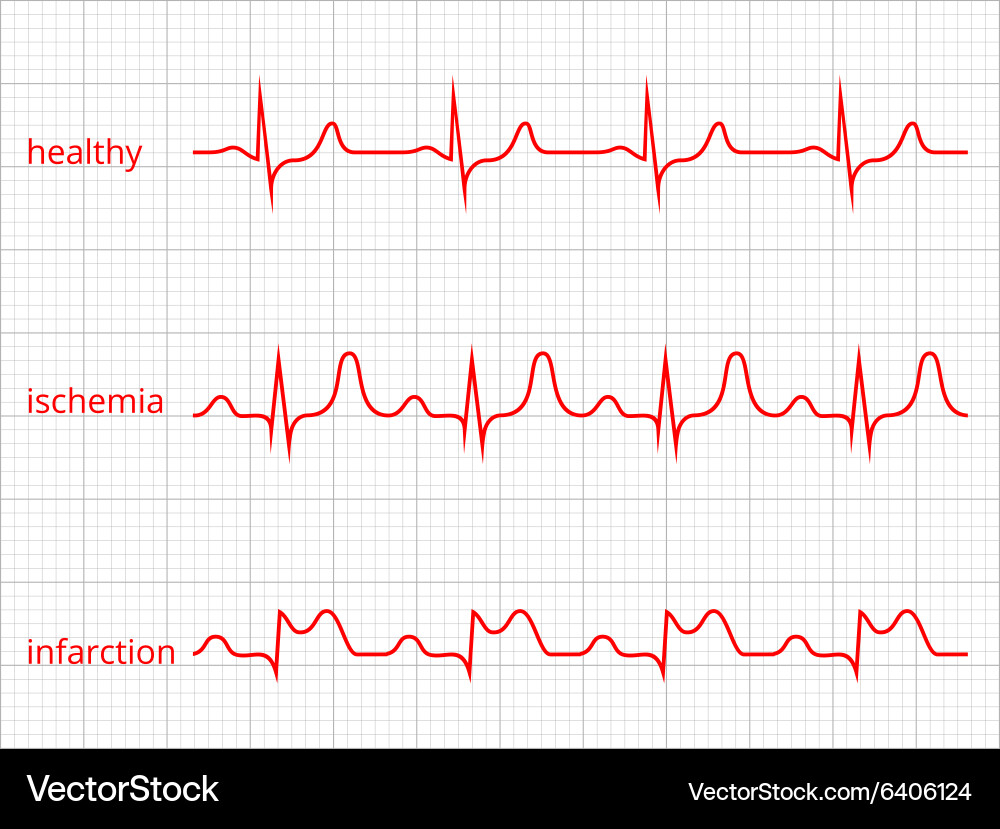 Heart cardiogram charts set healthy Royalty Free Vector