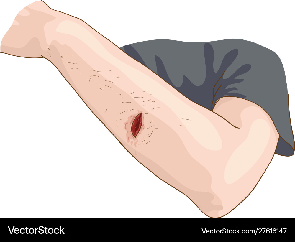 Wound Royalty Free Vector Image - VectorStock