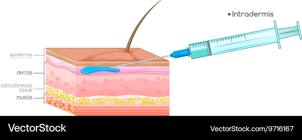 Injection under human skin Royalty Free Vector Image