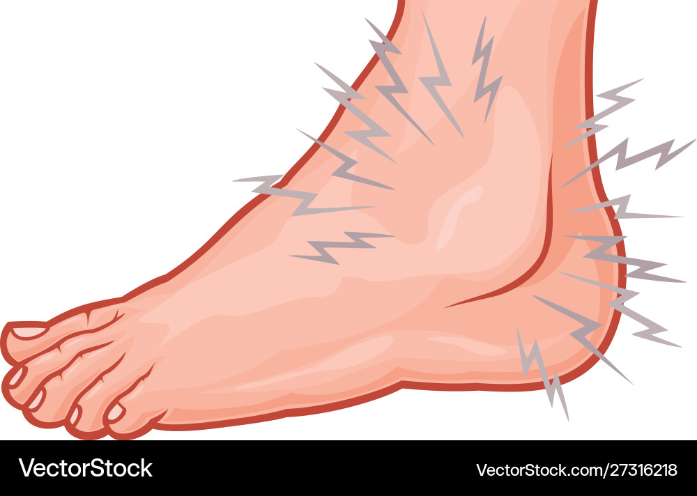 Ankle sprain Royalty Free Vector Image - VectorStock