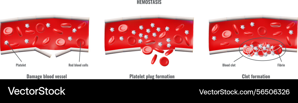 Hemostasis medical 3d infographic design Vector Image