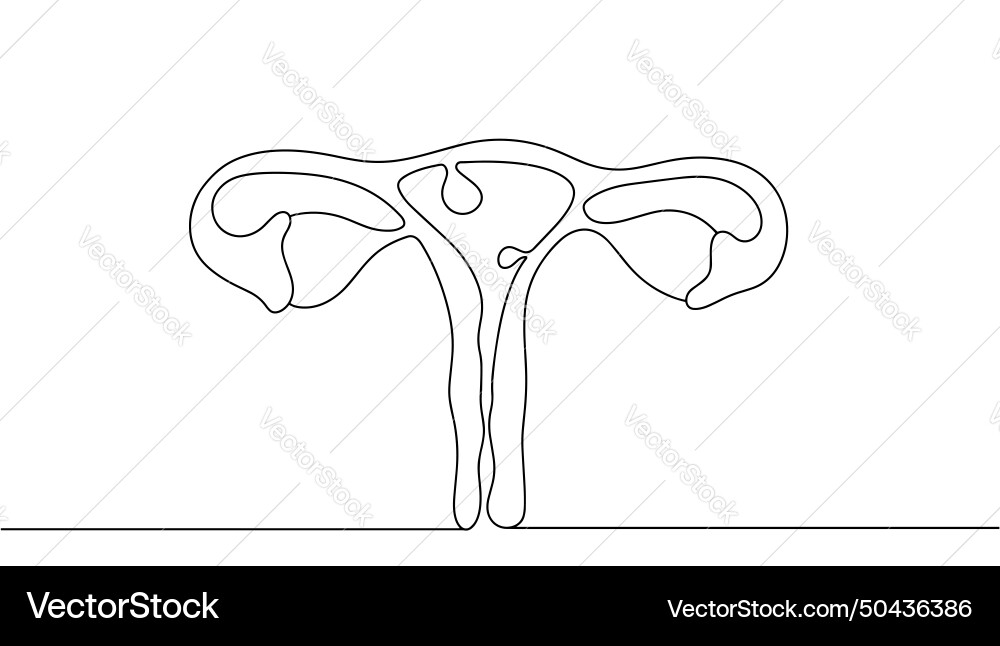 Uterus endometrial polyp disease gynecology Vector Image
