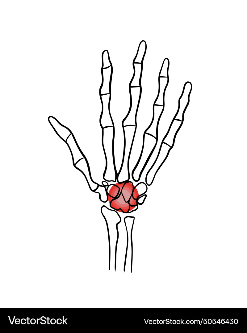 Wrist pain hand Royalty Free Vector Image - VectorStock