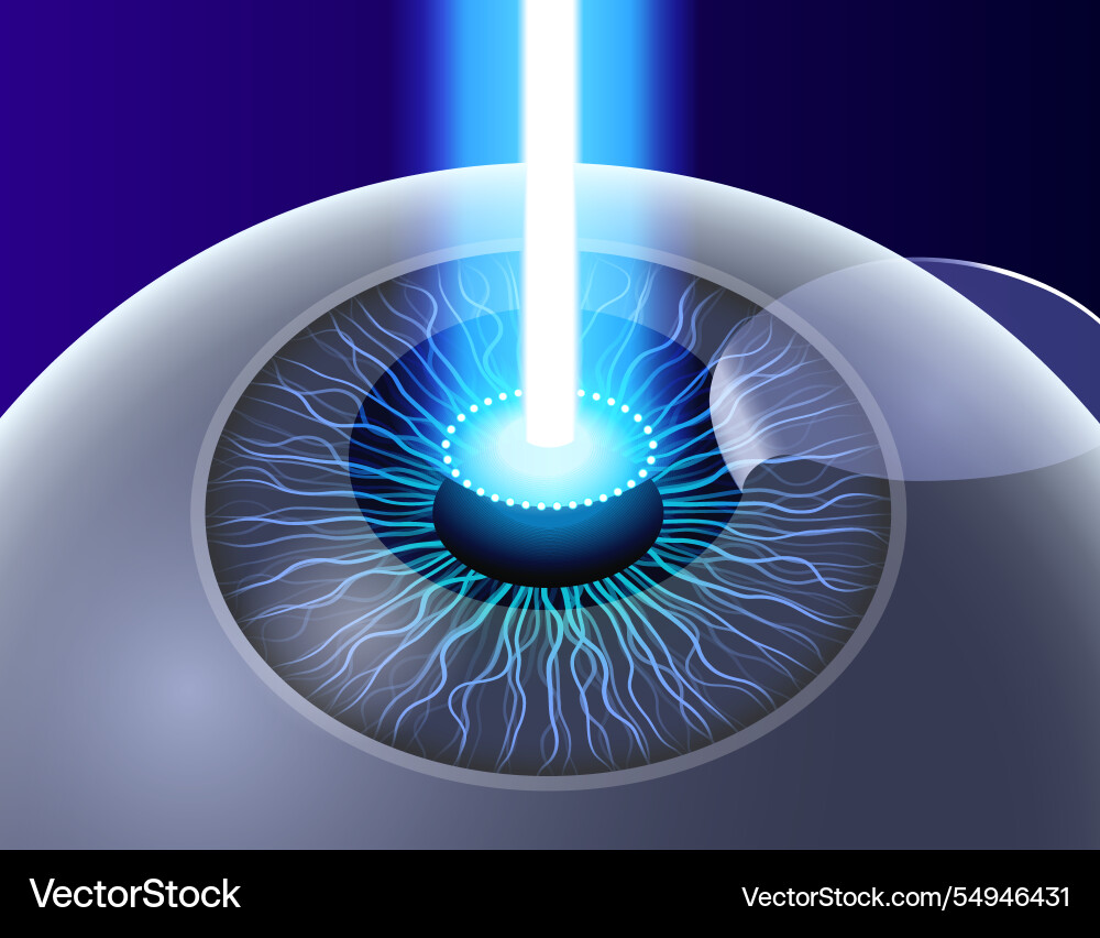 Lasik eye surgery Royalty Free Vector Image - VectorStock