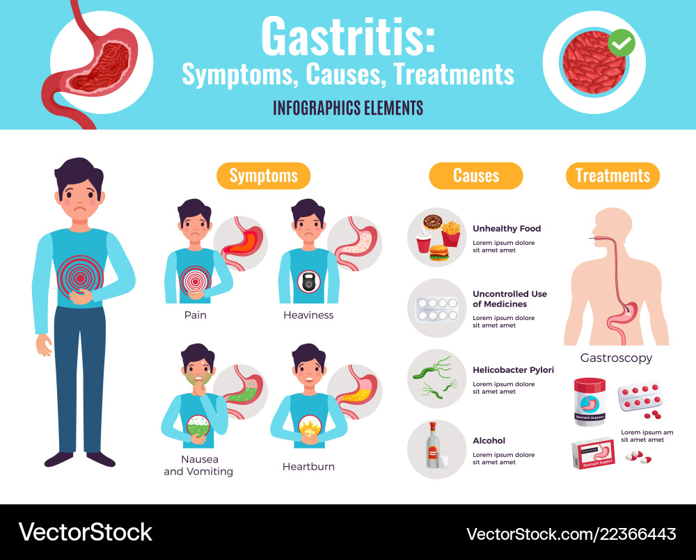 Gastritis infographic poster Royalty Free Vector Image
