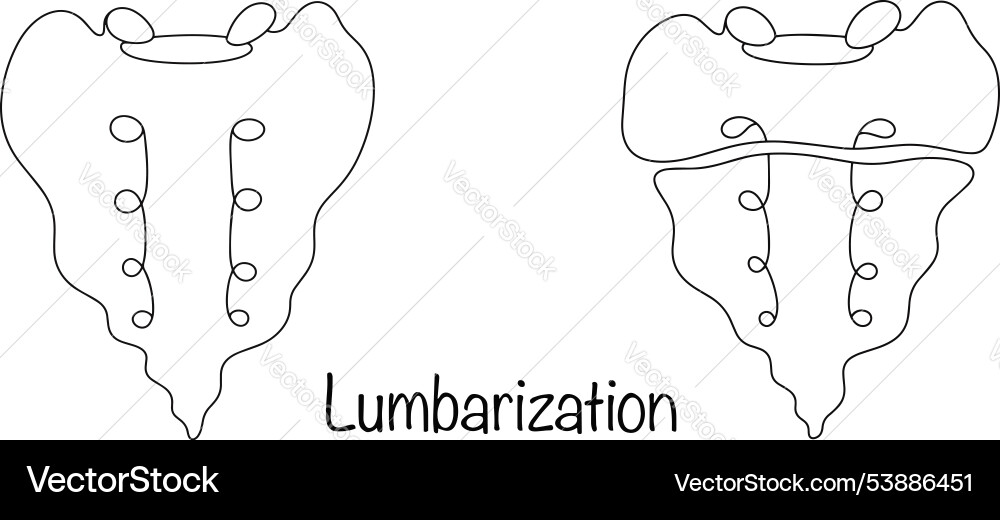 Lumbarization Royalty Free Vector Image - VectorStock