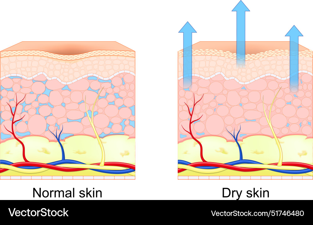 Dry and normal human skin Royalty Free Vector Image