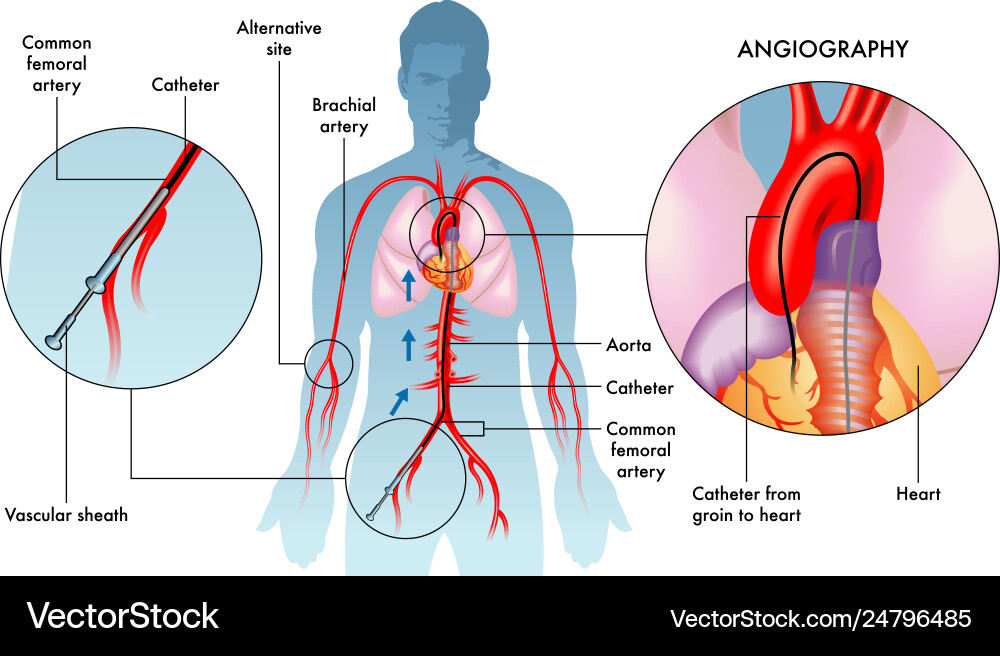 Parts Body Groin Vector Images (99)