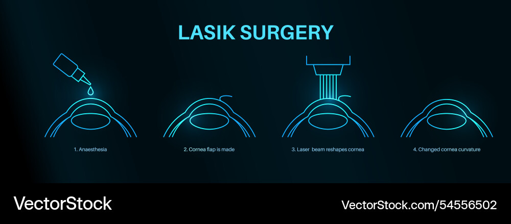 Lasik eye surgery Royalty Free Vector Image - VectorStock