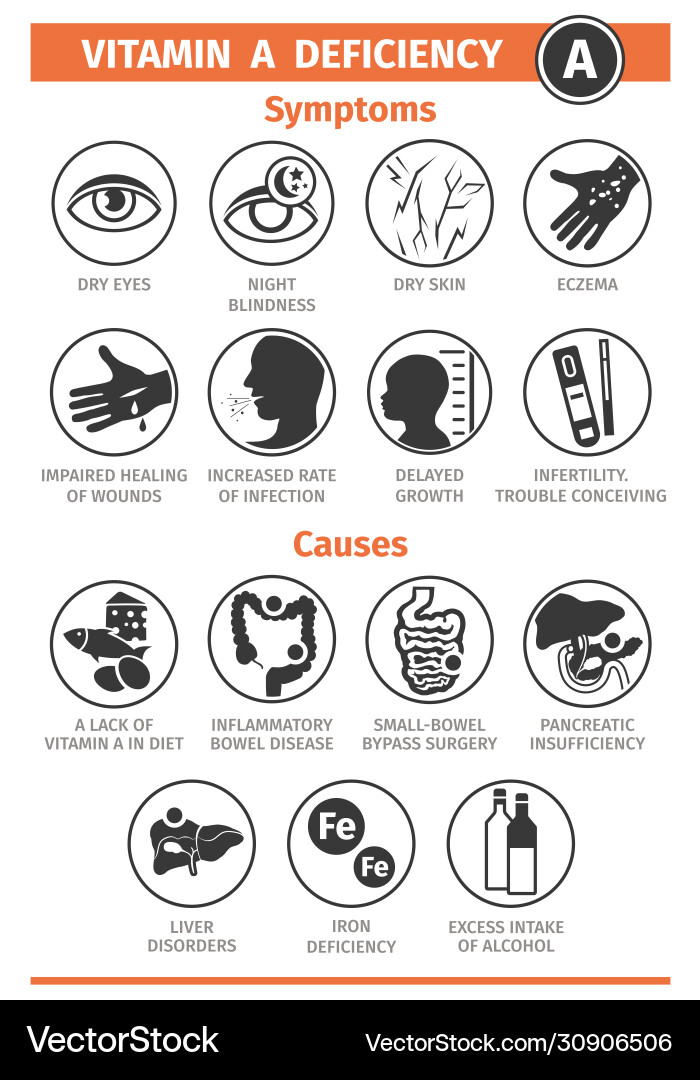 Vitamin A Deficiency Symptoms – Royalty-Free Vector | VectorStock