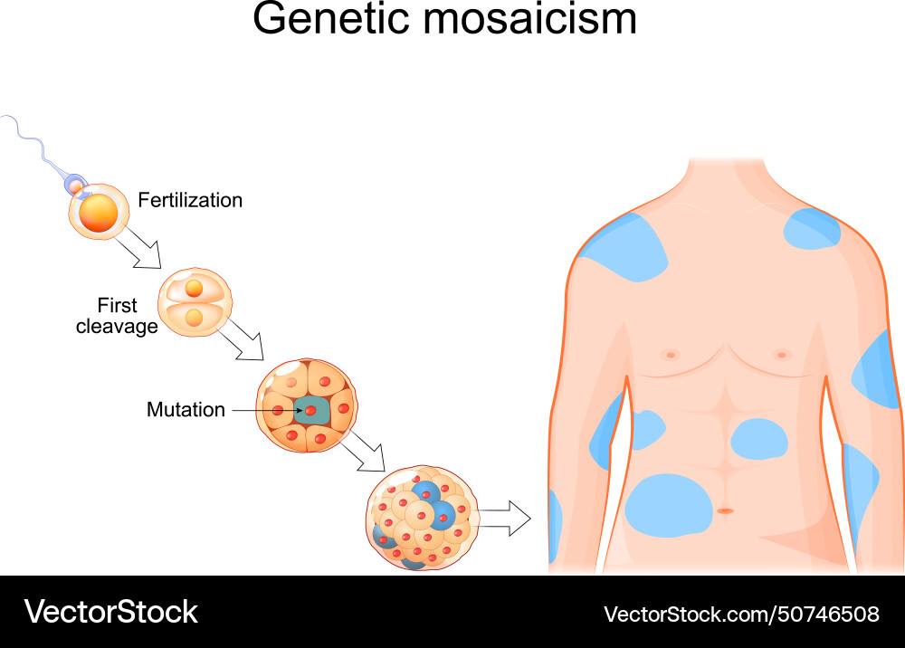 Genetic mosaicism somatic mutation Royalty Free Vector Image