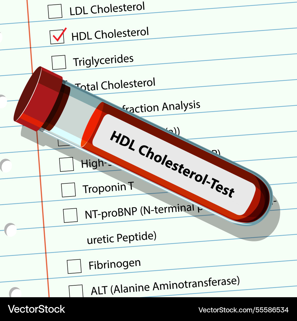 Image of a blood test checklist Royalty Free Vector Image