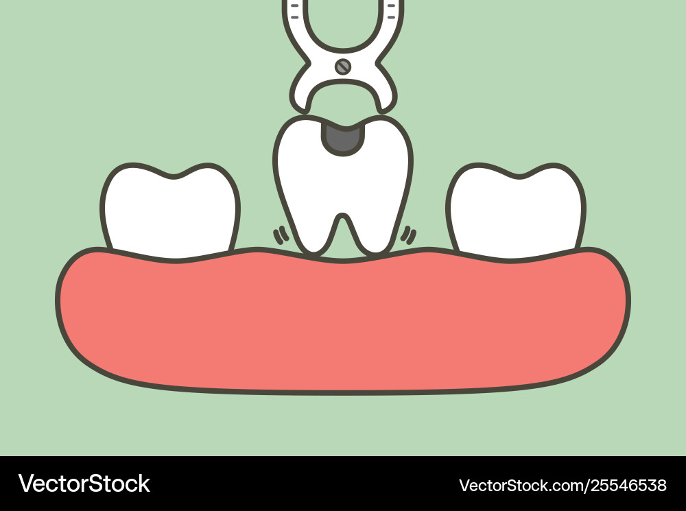 Tooth extraction with dental tools Royalty Free Vector Image