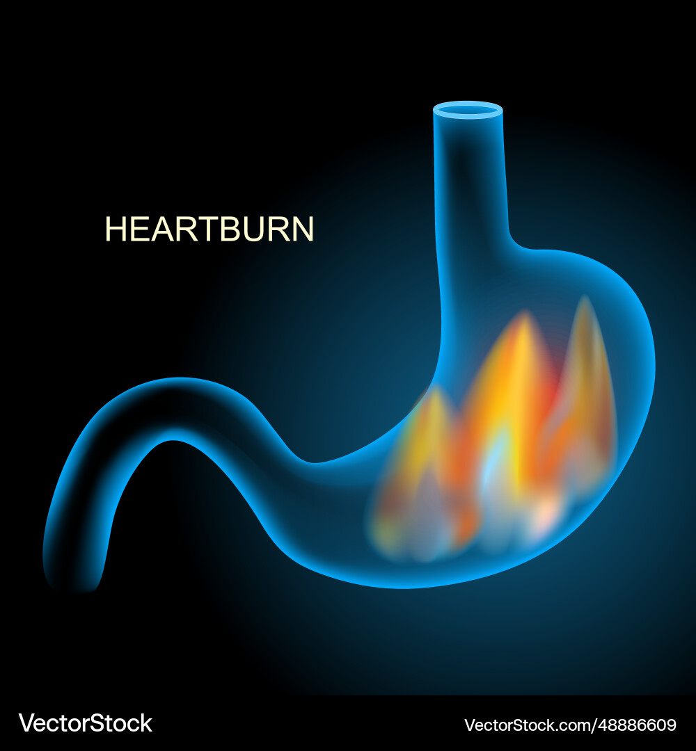 Realistic Stomach with Flame - Heartburn Vector Image