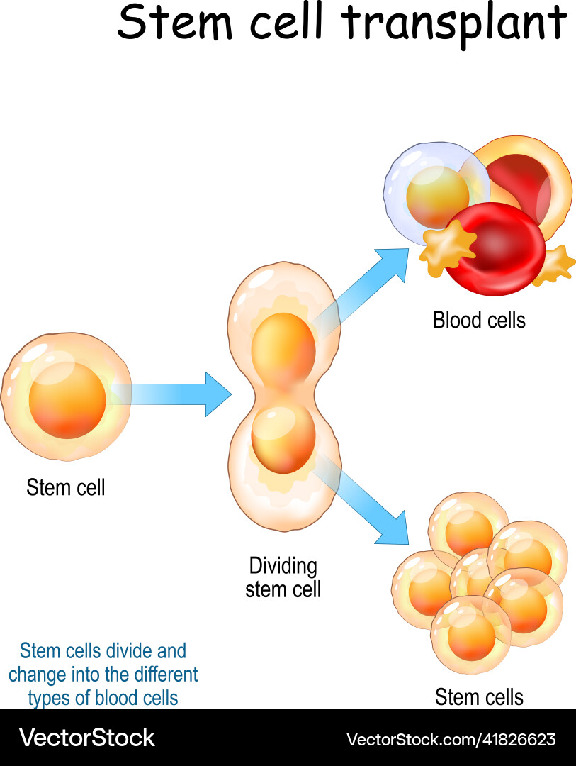 Stem cell transplant Royalty Free Vector Image