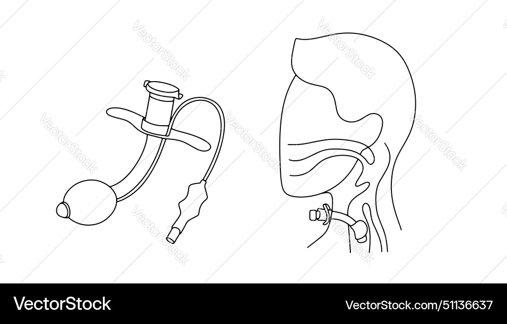 Tracheostomy Royalty Free Vector Image - VectorStock