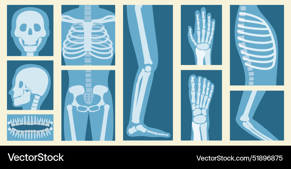 3d isometric flat set of xray human body Vector Image