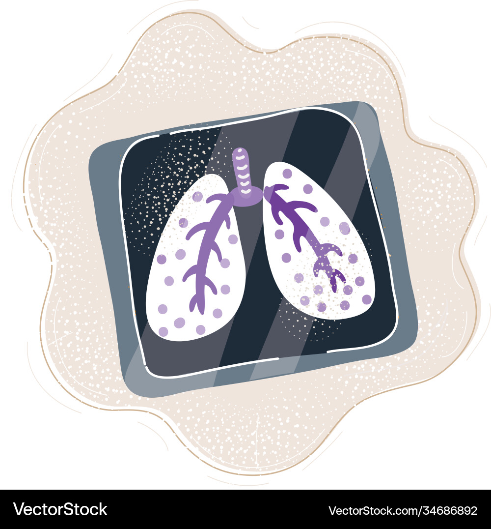 X-ray chest Royalty Free Vector Image - VectorStock