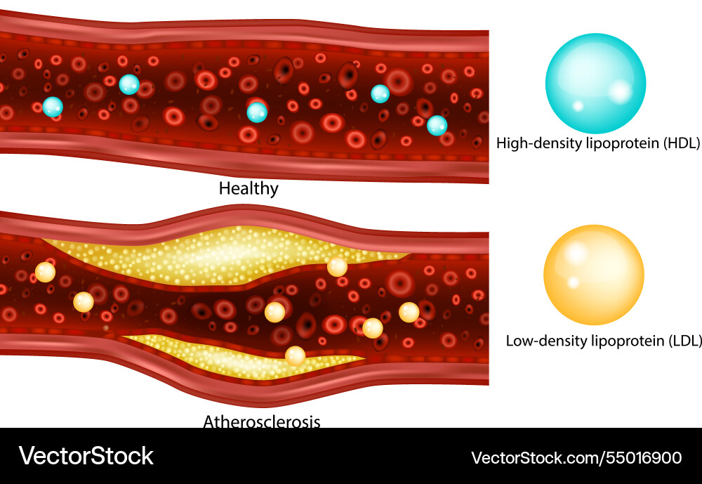 Cholesterol low-density lipoprotein ldl and high Vector Image