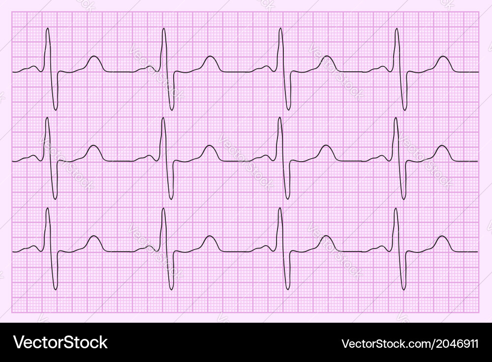 Heart analysis electrocardiogram graph ecg Vector Image