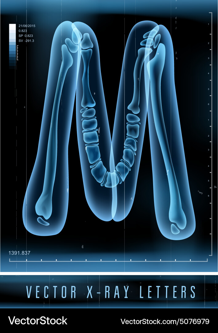 X Ray Blue Transparent 3d Logo Logo Amazon.com: YKing1 Jet Engine