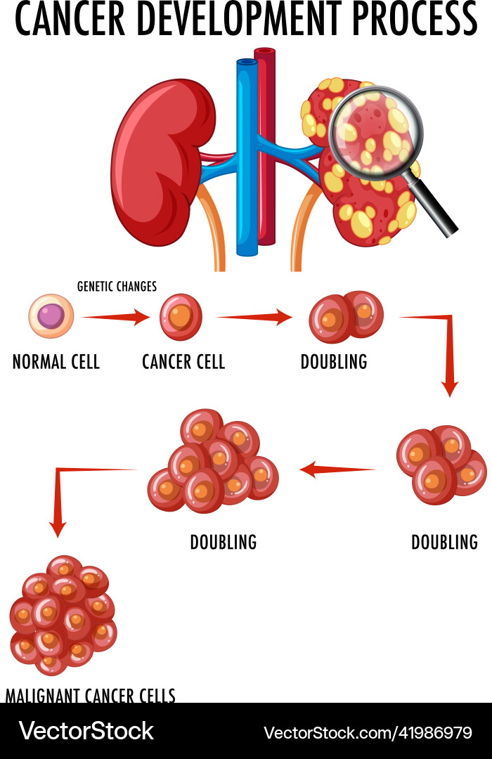 Diagram showing cancer development process Vector Image